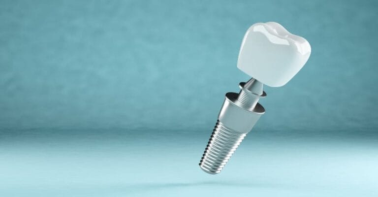 Screwless Dental Implants: Types, Limitations and Prices